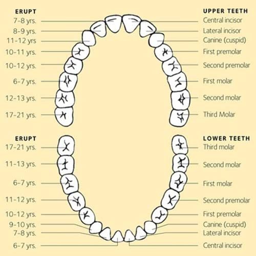 Wisdom Teeth Diagram